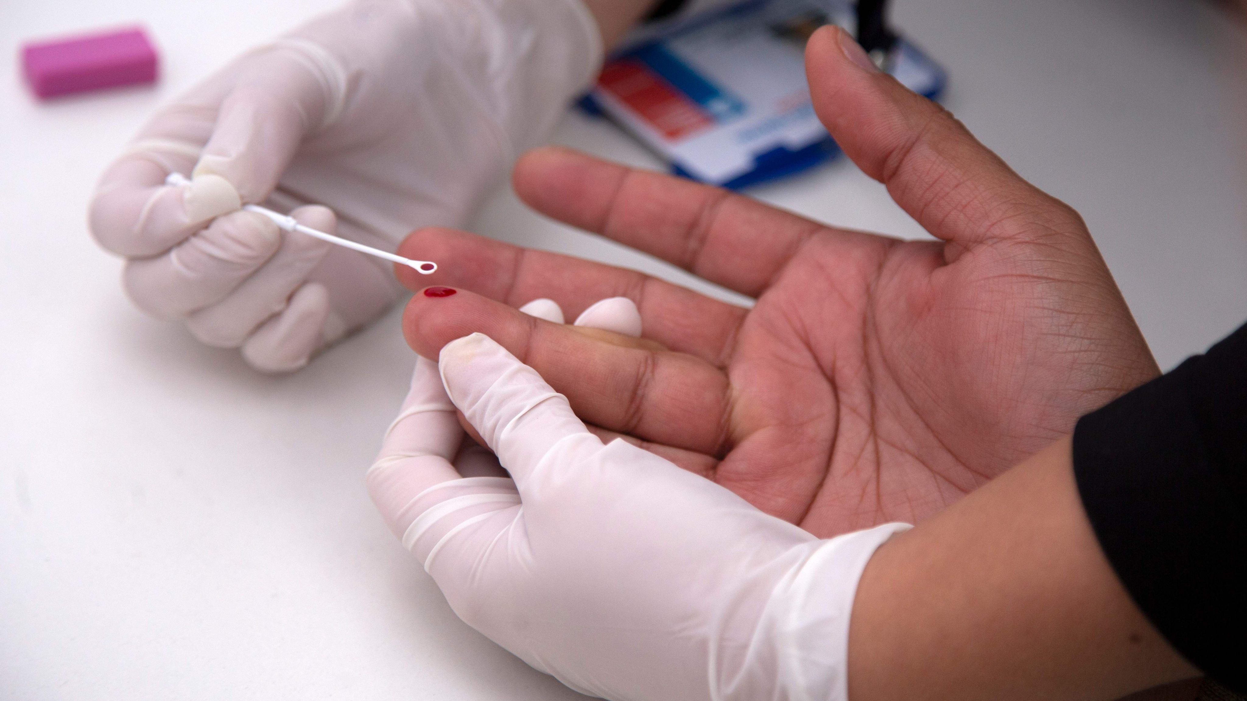 HIV Tests Rezeptfrei In sterreichs Apotheken Erh ltlich sterreich 